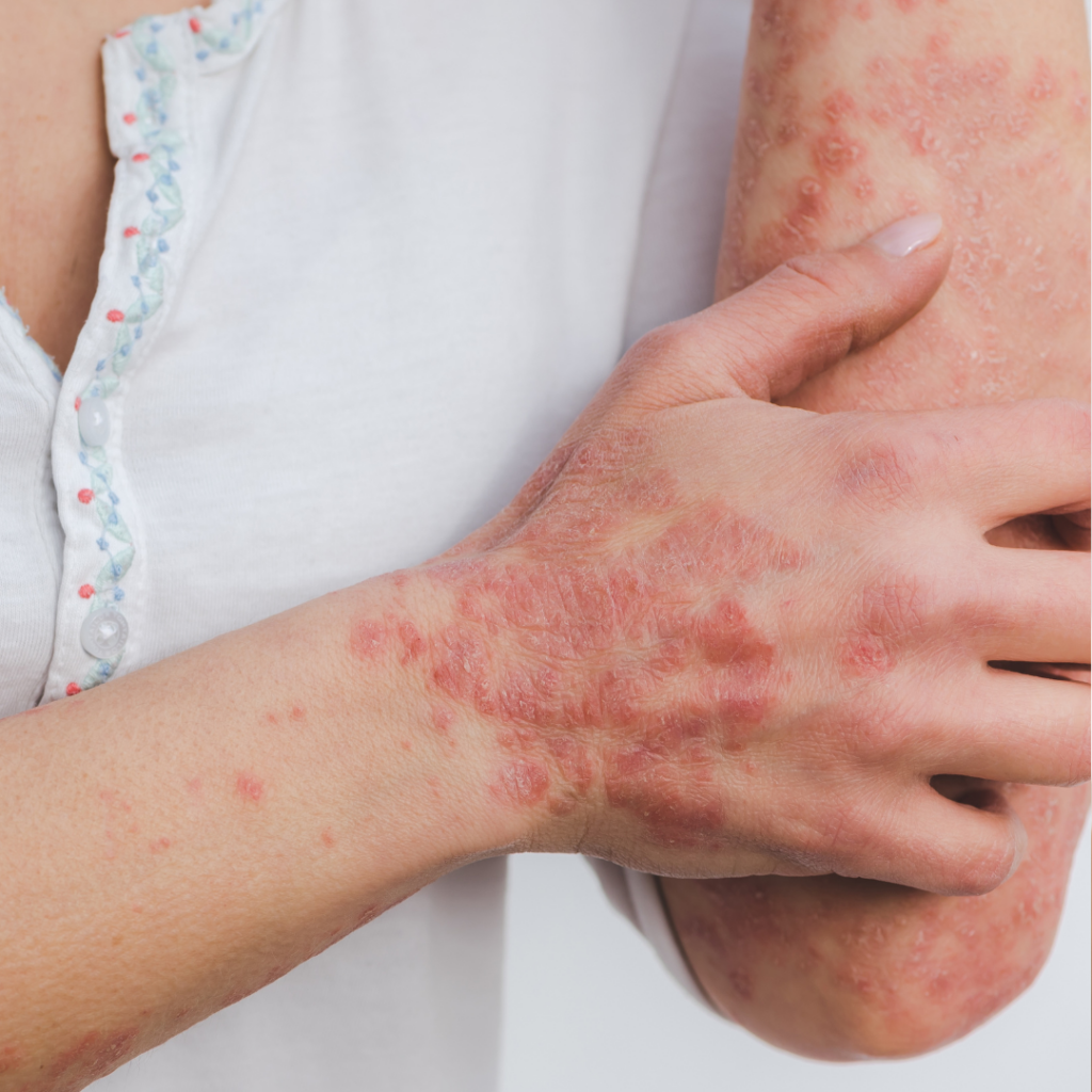 Dr. Matt le Roux | Certified Functional Medicine Practitioner